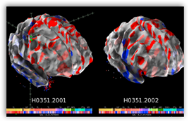 The First Comprehensive Gene Map of the Human Brain Released by the ...